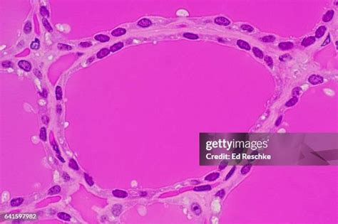 Thyroglobulin Photos And Premium High Res Pictures Getty Images