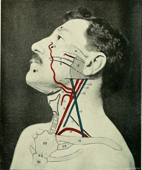 Common Carotid Artery Physiopedia