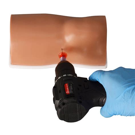 Io Trainer Mastering Intraosseous Access For Efficient Emergency Ultrassist