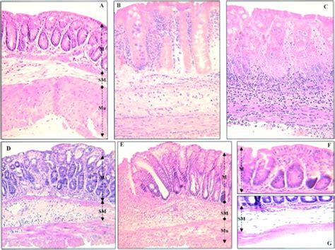 Representative Histological Sections Of Colon Tissues Of Balbc Mice