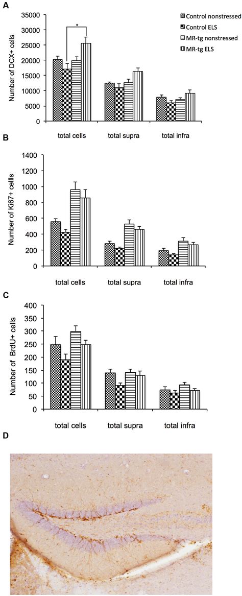Frontiers Overexpression Of Mineralocorticoid Receptors In The Mouse