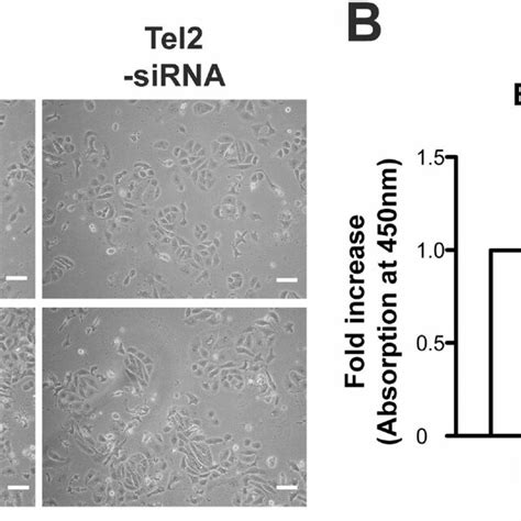 Depletion Of Tel2 Suppresses Cell Proliferation Download Scientific