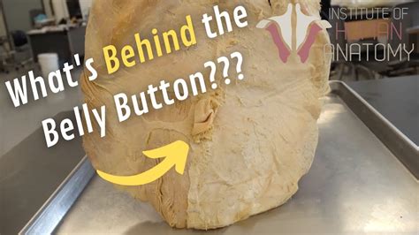 Belly Button Anatomy Diagram