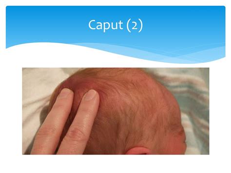 Ppt Normal Newborn Care Powerpoint Presentation Free Download Id