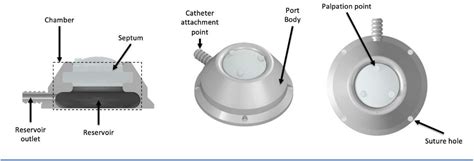 Radiographic Imaging Of Power Injectable Medical Access 47 Off