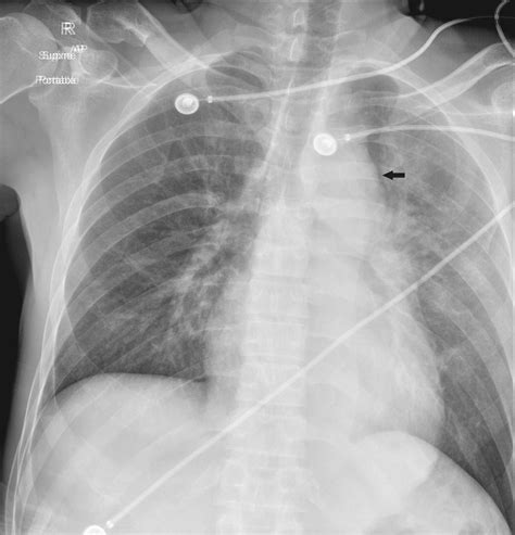Radiologic Imaging Of Thoracic Abnormalities Clinical Tree