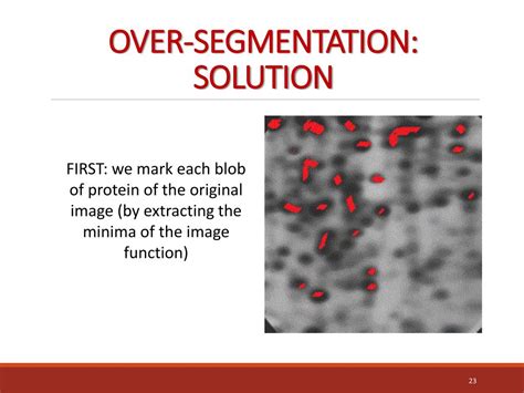 Ppt The Watershed Segmentation Powerpoint Presentation Free Download