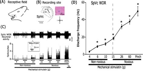 General Characteristics Of Spinal Trigeminal Nucleus Caudalis Spvc Download Scientific