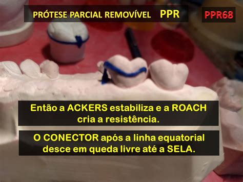 Professor Gilmar Zukowski gilmarprotese blogspot 3ºANO PPR