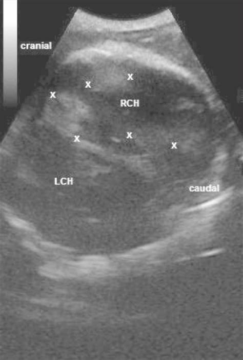 Transtemporal Window Oblique Dorsal Plane Note Between The X Download Scientific Diagram Transtemporal Window Oblique Dorsal Plane Note Between The X Download Scientific Diagram