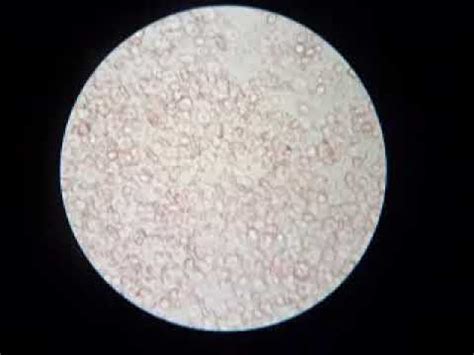 Eritrocitos Vistos Por Un Microscopio YouTube