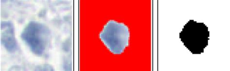 example of nucleus segmentation left the original 80x80 pixel patch