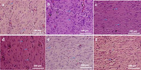 Histological Studies Of Wound Healing By Hande Staining After 8 Weeks In