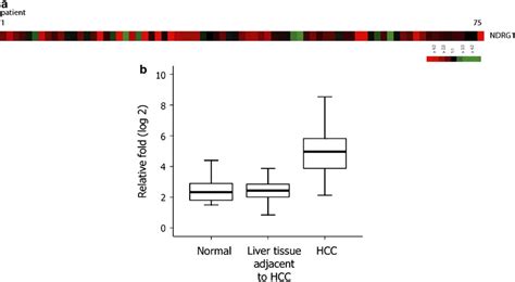 Overexpression Of Ndrg1 Is An Indicator Of Poor Prognosis In
