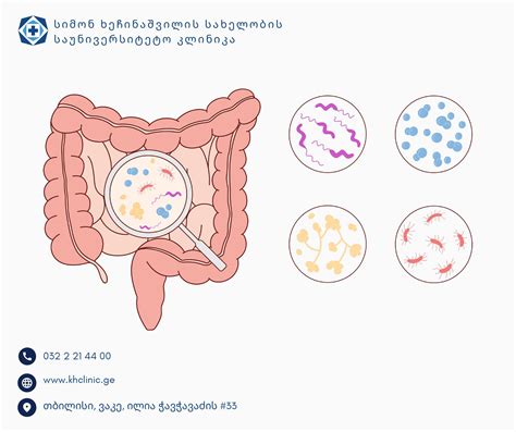 რა უნდა ვიცოდეთ კუჭ ნაწლავის ინფექციებზე ჯანმრთელობა Vidal Ge