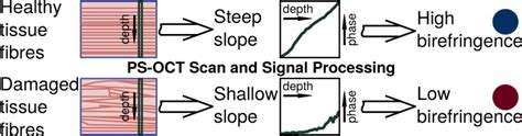 Polarization Sensitive Oct Obel