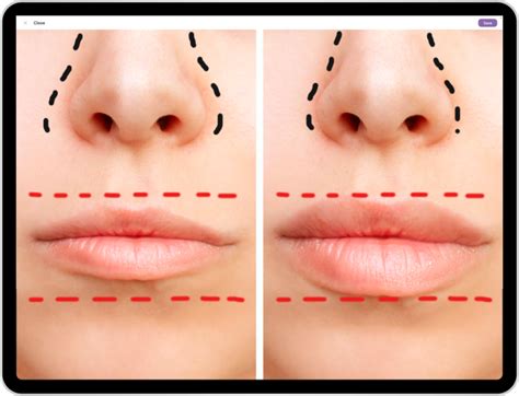 Switch To Neosoft Neosoft