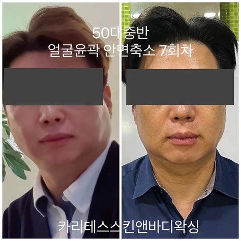 광교피부관리ㅣ수지피부관리ㅣ광교왁싱ㅣ용인피부관리ㅣ얼굴축소ㅣ경락 ㆍ카리테스 베스트 기법 맞춤형 ㆍv라인 입체윤곽관리 ㆍ안면