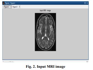 Improved Bat Algorithm Using Super RegionVolume Segmentation For