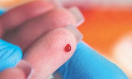 Best Practices For Fingerstick Capillary Sampling Clinical Lab Products