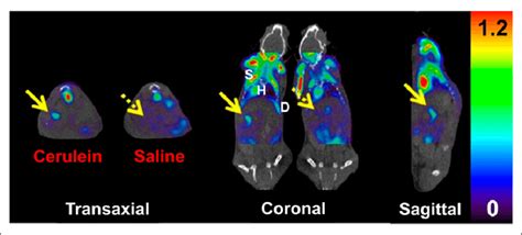18 F Fdg Petct Of Treated Cerulein And Control Saline Mice
