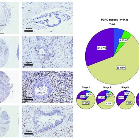 Cd4 T Cell Spatial Distribution Patterns In The Tumor Tissue Download Scientific Diagram