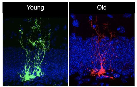 Study Reveals Neural Stem Cells Age Rapidly
