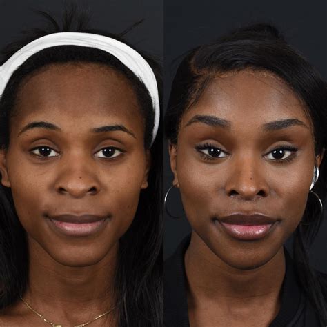 Tommy Liu Md Drtommyliu • Instagram Photos And Videos