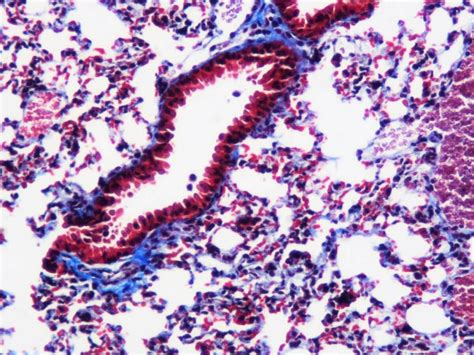 Kh07007 Massons Trichrome Stain Kit Bqc Bioquochem