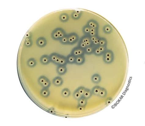Staphylococcus Aureus On Baird Parker Agar Kerellos Shawky Posted On The Topic Linkedin
