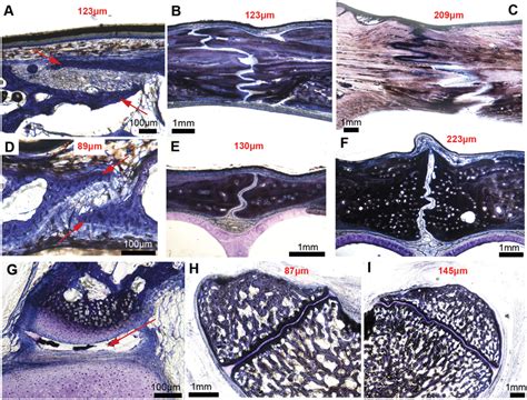 Transverse Sections Through The Frontoparietal Suture The Internasal