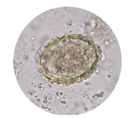 Parasitology Exam 1 Flashcards Quizlet