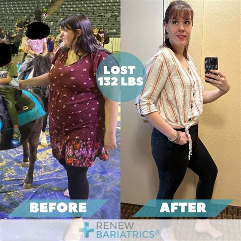 Gastric Bypass Pin On My 600 Lb Life Tlc