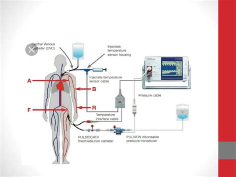 Cardiac Output Measurment And Monitoring Ppt 1 Pptx