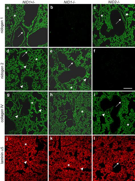 Indirect Immunofluorescence Staining Was Performed On Lung Sections