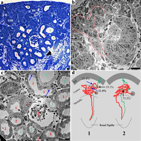 Light And Electron Micrographs Derived From The Same Serial Section