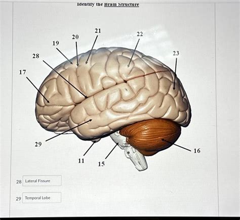 Solved Identify The Brain Structure Chegg