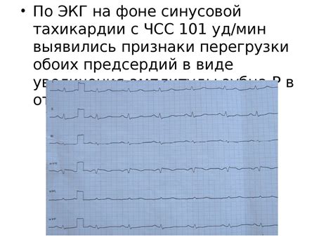Неревматический миокардит презентация онлайн