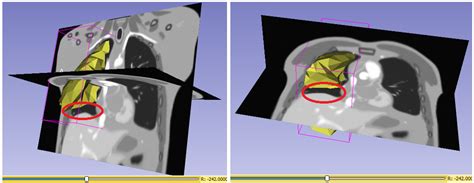 Interpolate A Given Point From Nifti Dvf Image Volume Beginner Questions Itk