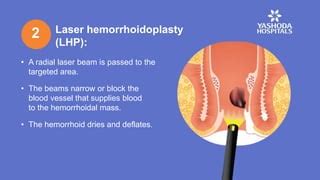 Piles Types Causes And Symptoms Piles Laser Treatment In Hyderabad Ppt