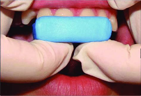 Centric Relation Record Power Centric Technique Anterior Segment Download Scientific Diagram