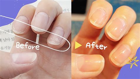 수영 다니면서 갈라진 얇은손톱 문제발생💥 손톱강화제 네일하드너 필수템 Youtube