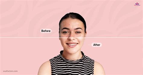 Best Makeup For Rosacea Safe 10 Makeup Products To Try