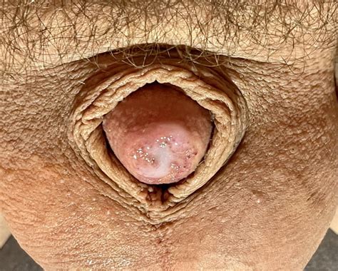 Tiny We We Micro Cock Nude Pics XHamster Tiny We We Micro Cock Nude Pics XHamster