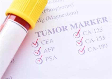 News Elevated Tumor Markers Does It Indicate Cancer