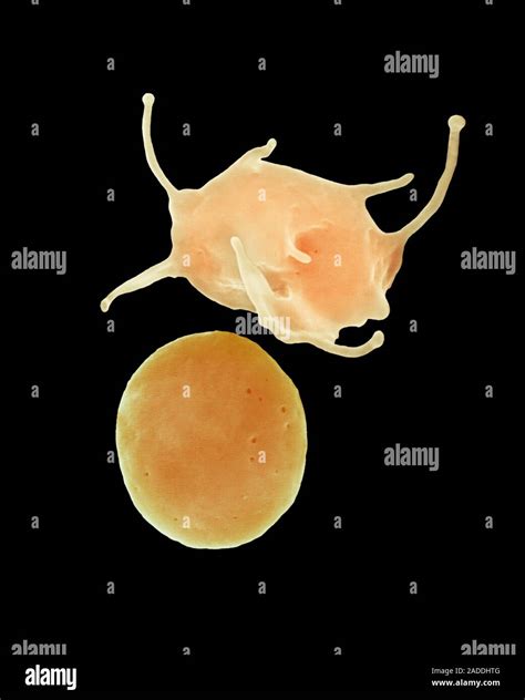 Activated And Non Activated Platelets Coloured Scanning Electron Micrograph SEM Platelets