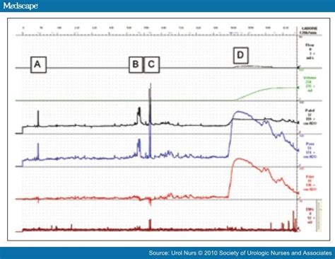 traces making sense of urodynamics testing