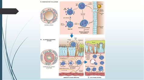 Pathogenesis Of Asthma Ppt