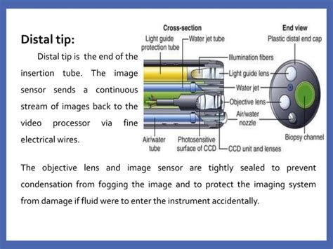 Endoscopy Pptx Digestive Disorders Diseases And Conditions