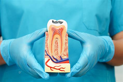 치과 임플란트 인공 치아 뿌리를 턱에 심고 치과 치료의 근관 잇몸 질환 치과 의사를 위한 치아 모델을 들고 있는 치과 의사 건강관리와 의술에 대한 스톡 사진 및 기타 이미지